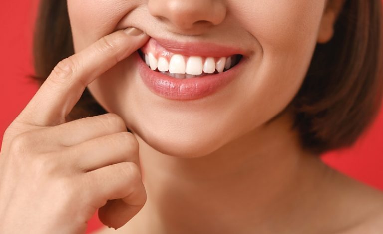 Cegah! Mari Kenali Penyebab Gusi Turun dan Cara Mengatasinya